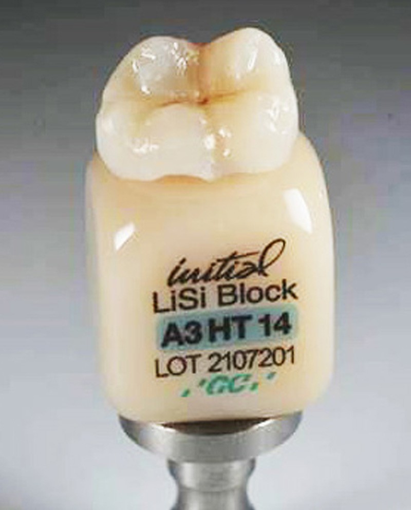 Initial Lisi Block